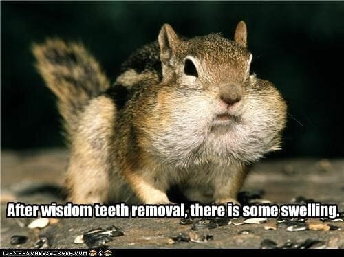 Funny Wisdom Teeth Photos To Share With Someone After Surgery